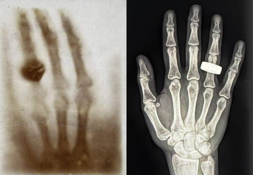 Waterloo, Ont. company’s tech responsible for first X-ray image taken ...